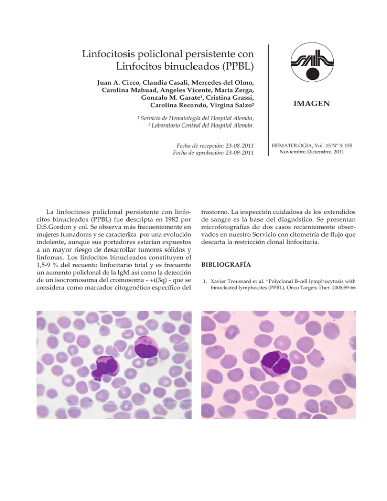 Linfocitosis policlonal persistente con Linfocitos binucleados (PPBL)