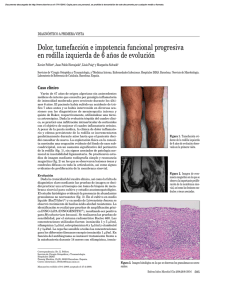 Tumefacción de rodilla derecha en paciente inmunodeprimido
