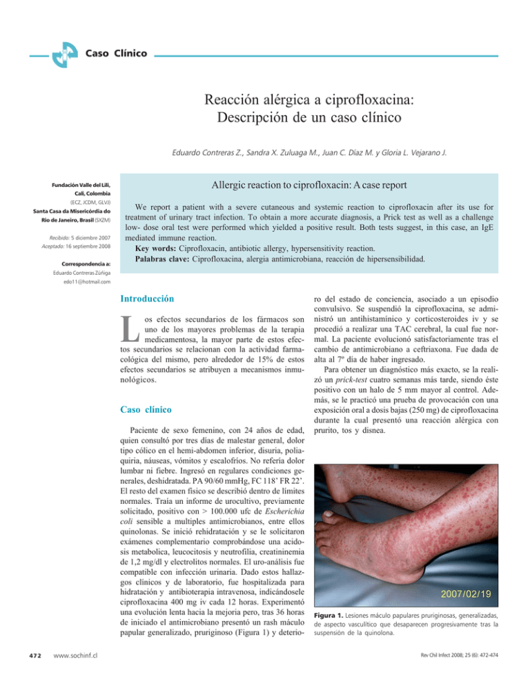 Reacción alérgica a ciprofloxacina: Descripción de un