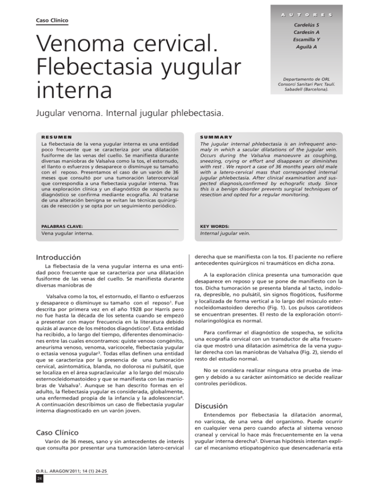 Venoma cervical. Flebectasia yugular interna