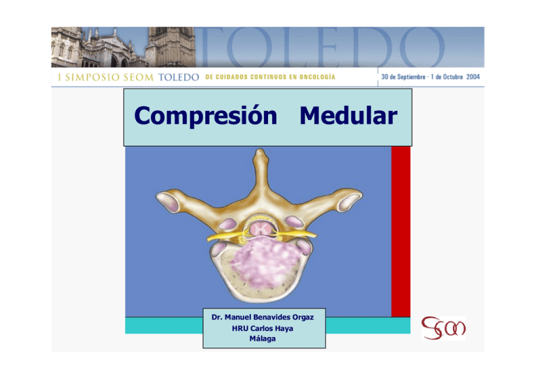 Compresión Medular