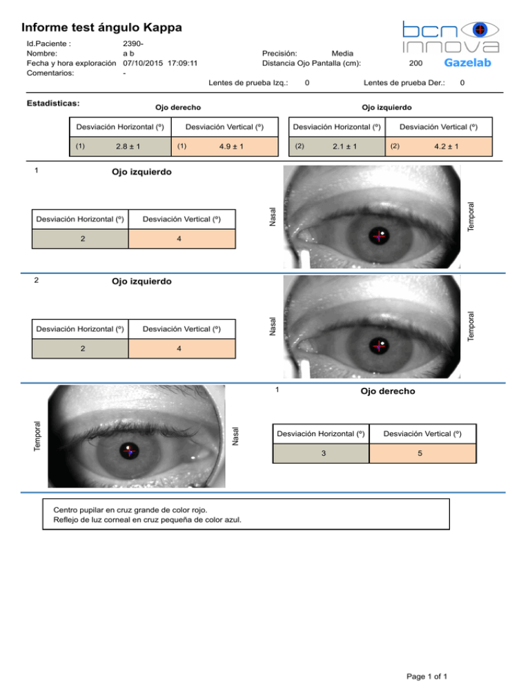 Informe test ángulo Kappa