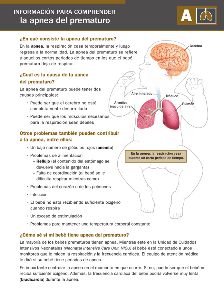 la apnea del prematuro - NICU