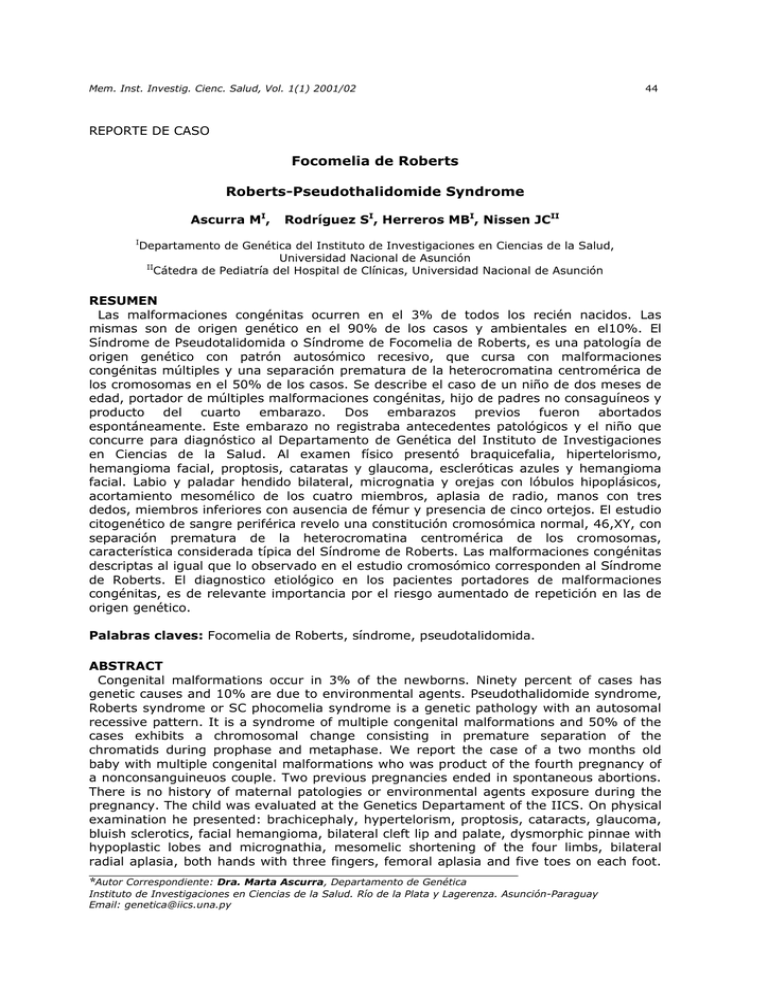 Focomelia de Roberts Roberts-Pseudothalidomide