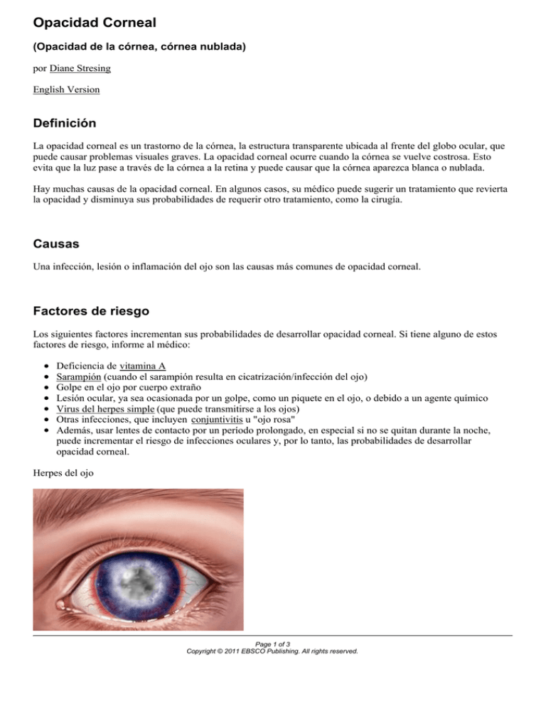 Opacidad Corneal