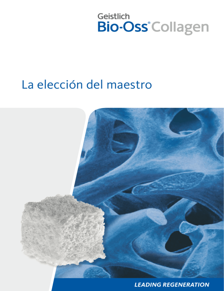 Ventajas Bio-Oss Collagen
